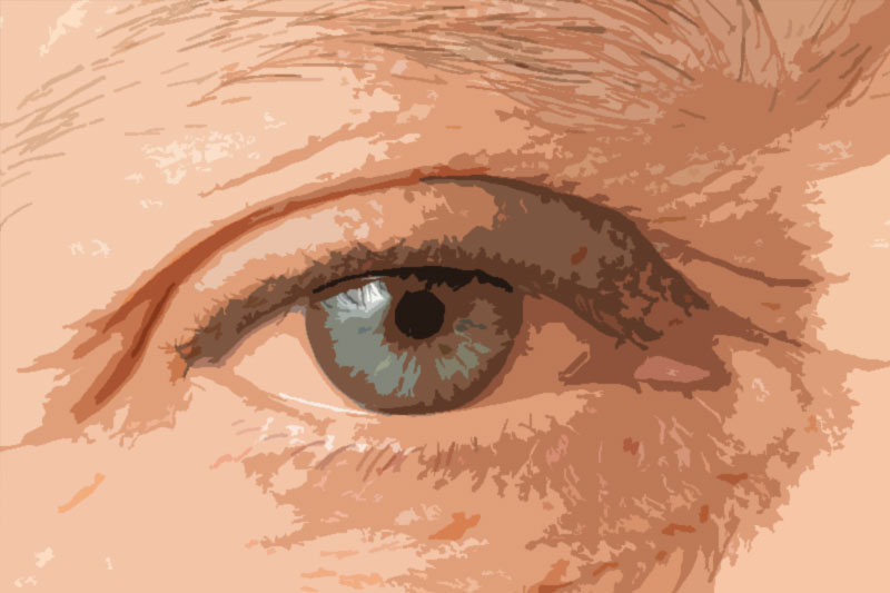 Eyes May Provide Early Warning On Stroke Factspedia