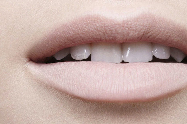Don't Ignore These 10 Health Warning Signs Your Lips are Telling You ...