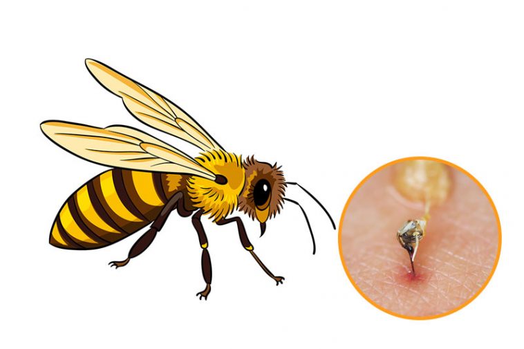 12 Bug Bites Anyone Should Be Able to Identify - Factspedia