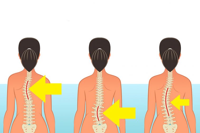 Avoid These 11 Common Activities That May Damage Your Spine - Factspedia