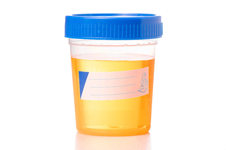 What the Color of Your Urine Reveals About Your Health - Factspedia