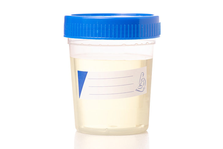 What the Color of Your Urine Reveals About Your Health - Factspedia