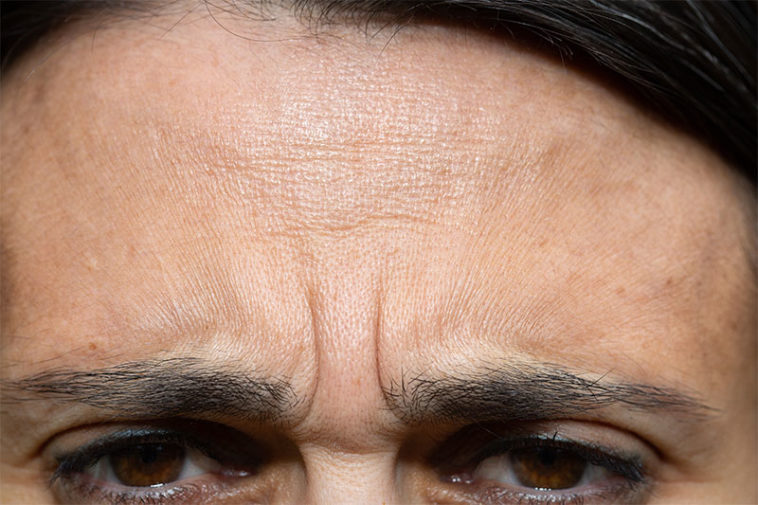 The 10 Most Common Signs Of Aging Skin (And How To Reverse Them ...