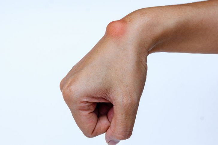 10 Causes of Hand Numbness Where You Need To See a Doctor Immediately ...