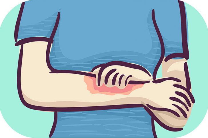 9 Signs Your Mystery Rash Is Something Serious - Factspedia