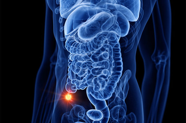 9 Organs You Can Actually Live Without - Factspedia