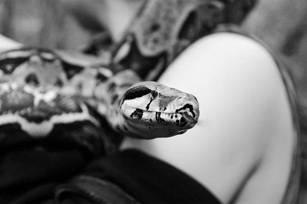 15 Weird And Strangest Medical Conditions That Are So Rare You Won’t ...