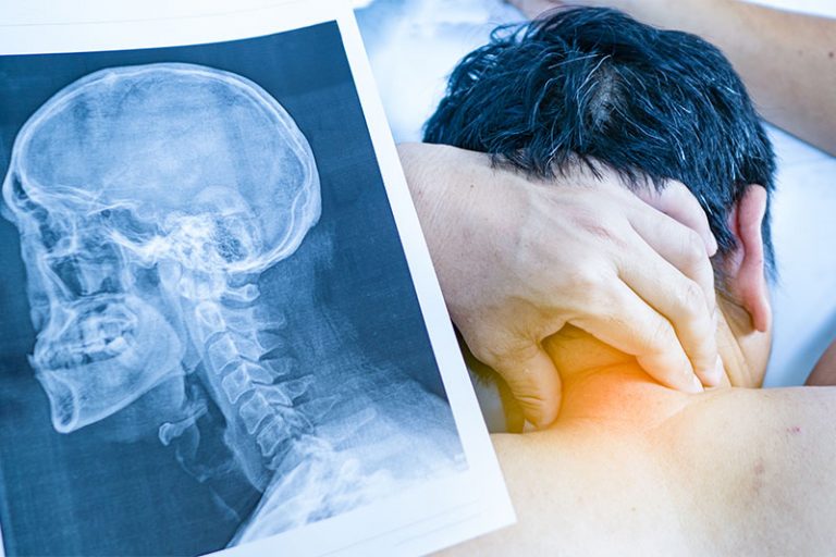 10 Causes of Hand Numbness Where You Need To See a Doctor Immediately ...