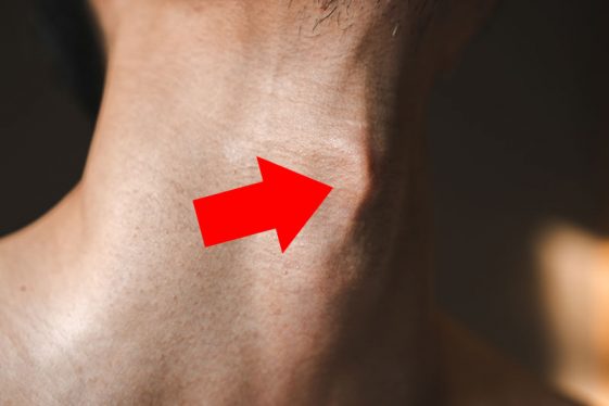 Why Do Men Have An Adam’s Apple? - Factspedia