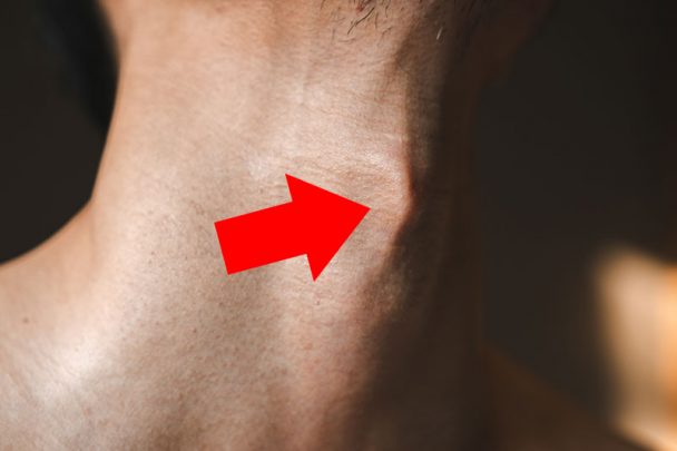 Why Do Men Have An Adam’s Apple? - Factspedia