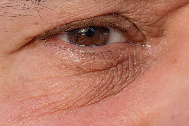 The 10 Most Common Signs Of Aging Skin (And How To Reverse Them ...