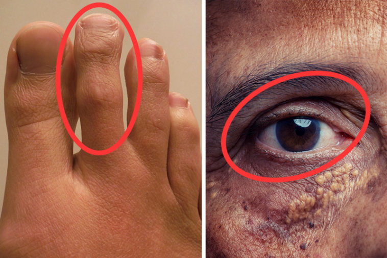 8 Signs That Your Body Is Crying Out For Help - Factspedia