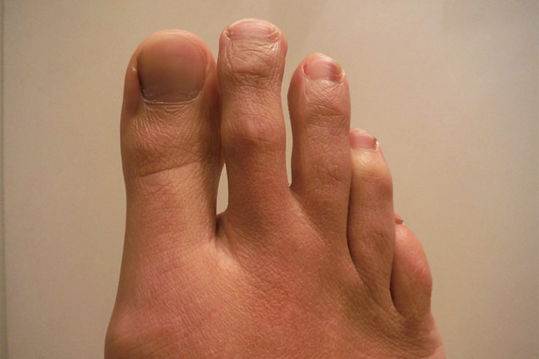 8 Signs That Your Body Is Crying Out For Help - Factspedia