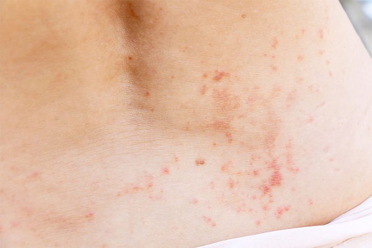Got Sensitive Skin? The 20 Most Common Skin Irritants You Must Avoid ...