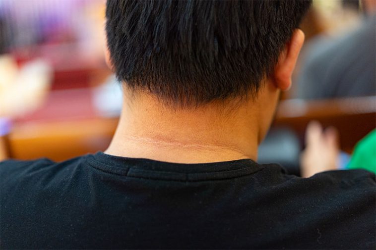 If You Have This On Your Skin, You May Have Diabetes - Factspedia