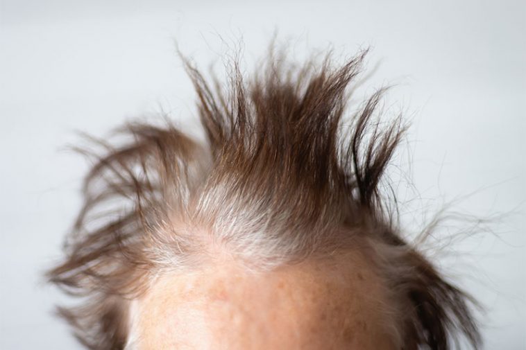 The Most Unusual Genetic Disorders on Earth - Factspedia