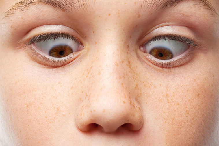 10 Simple and Relaxing Exercises for Your Eyes - Factspedia