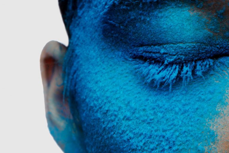 15 Weird And Strangest Medical Conditions That Are So Rare You Won’t ...