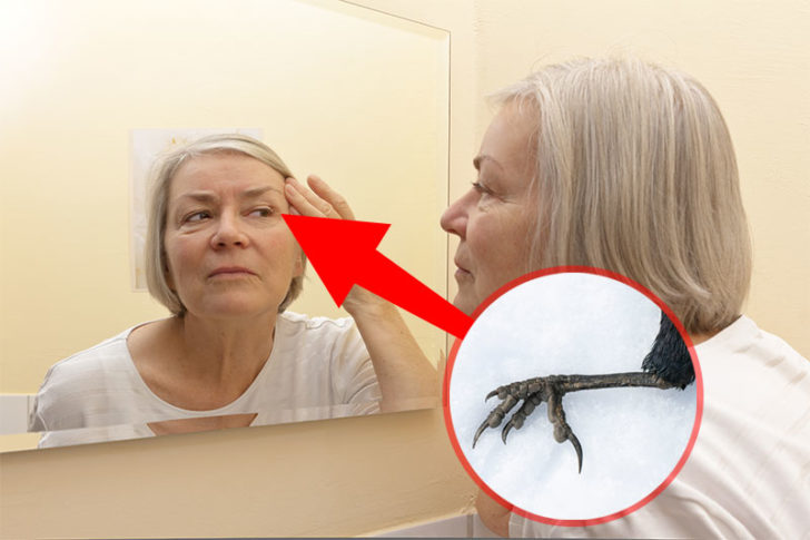 The 10 Most Common Signs Of Aging Skin (And How To Reverse Them ...