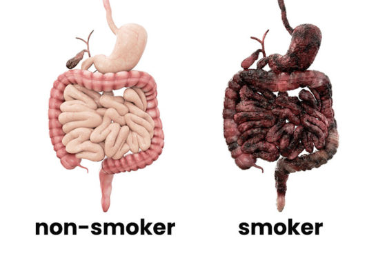 10 Innocent Mistakes That Put Your Kidneys In Trouble - Factspedia