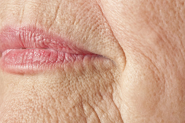 The 10 Most Common Signs Of Aging Skin (And How To Reverse Them ...